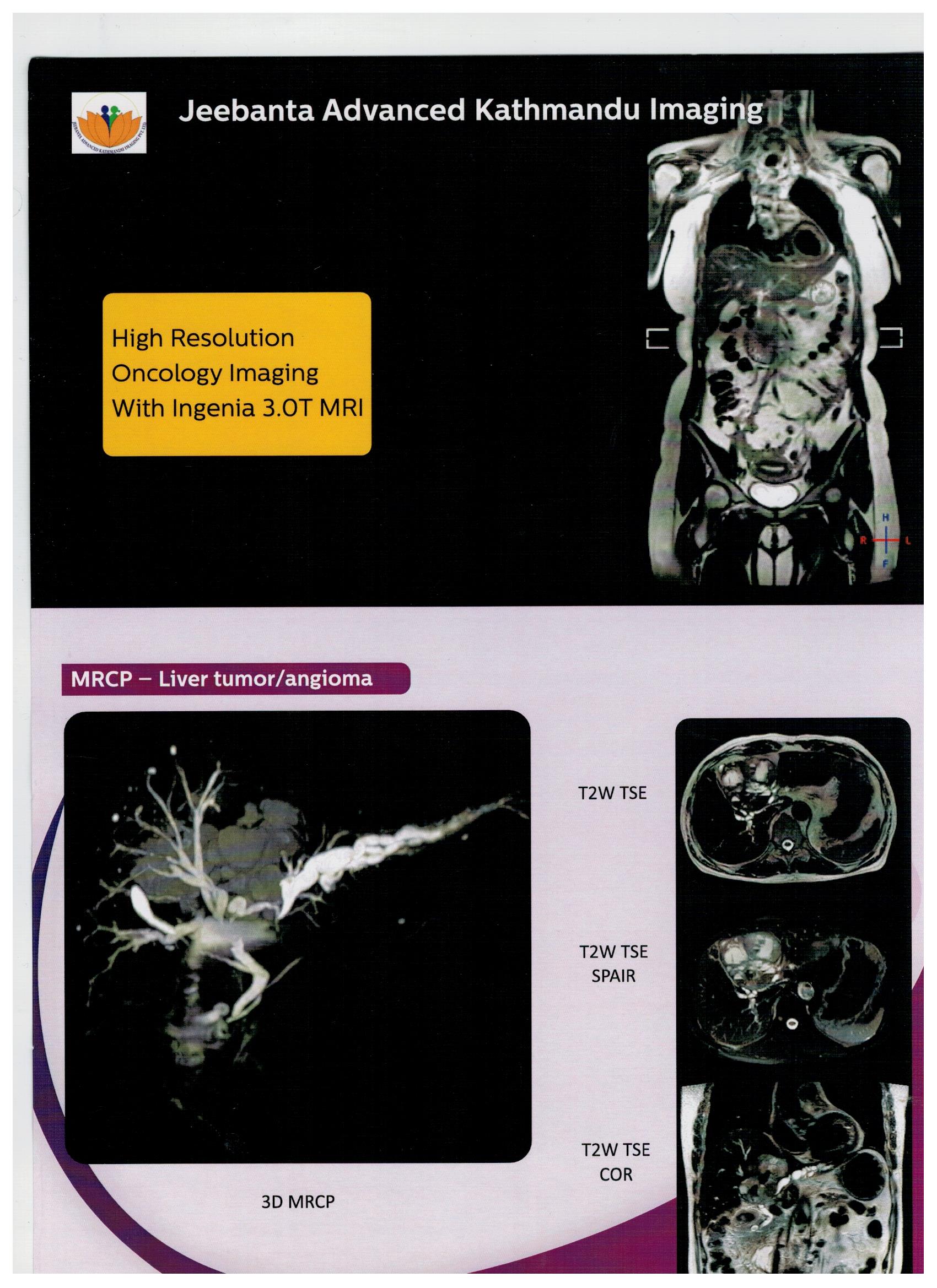 Gallery | Jeebanta Advanced Kathmandu Imaging Pvt. Ltd.